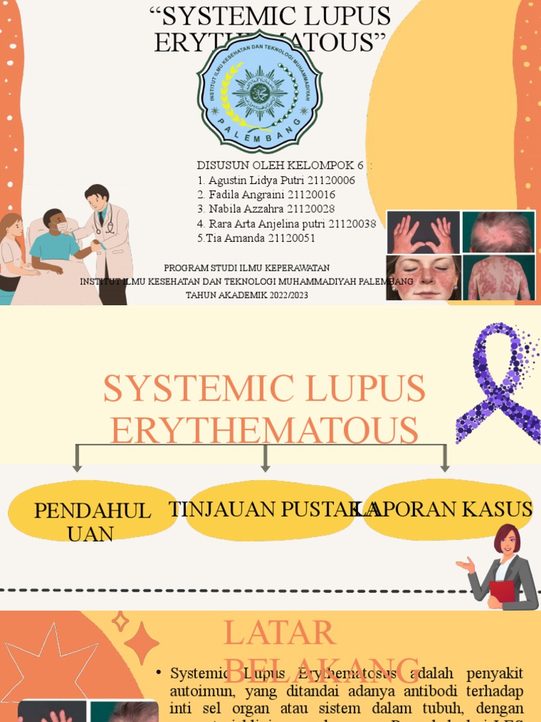 Lupus | PDF