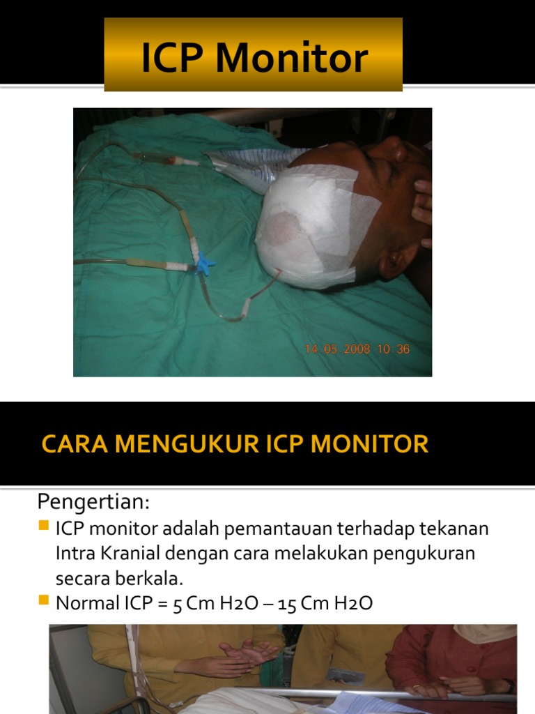 ICP Monitor - Workshop | PDF