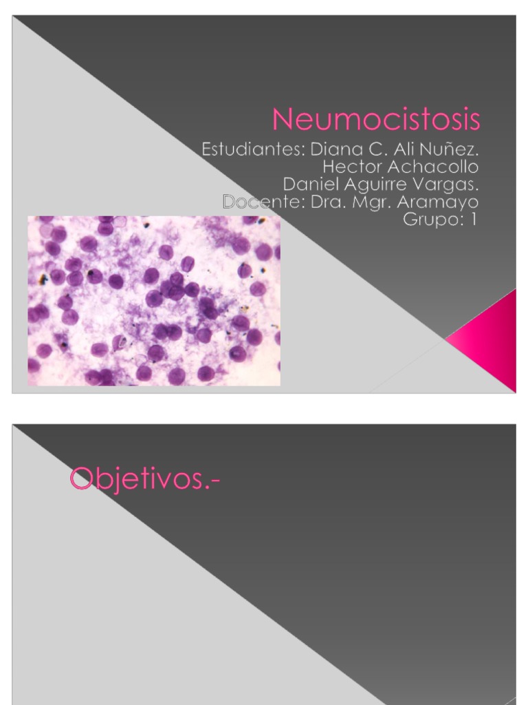 Neumocistosis | Tos | VIH / SIDA