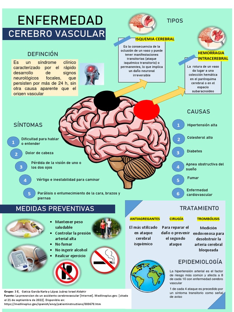 Enfermedad Cerebrovascular | PDF | Isquemia | Carrera