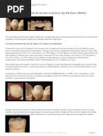 Exocad Manual How-to-install-Libraries Es Screen | PDF | Biblioteca ...