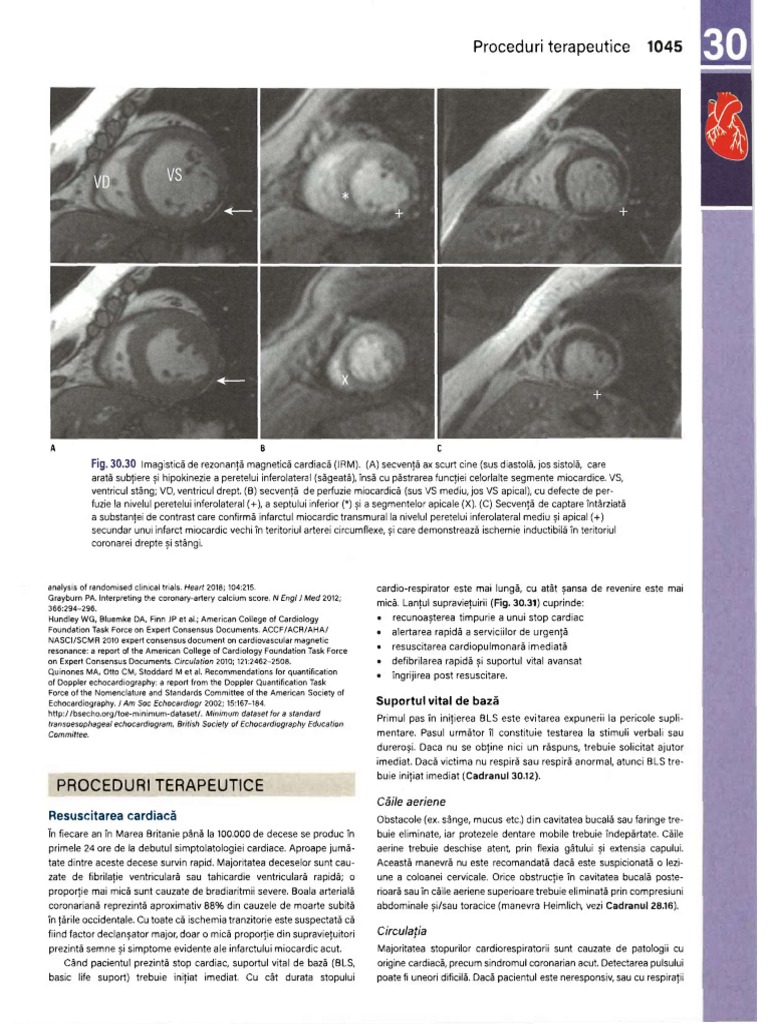 Kumar - Cardiologie | PDF