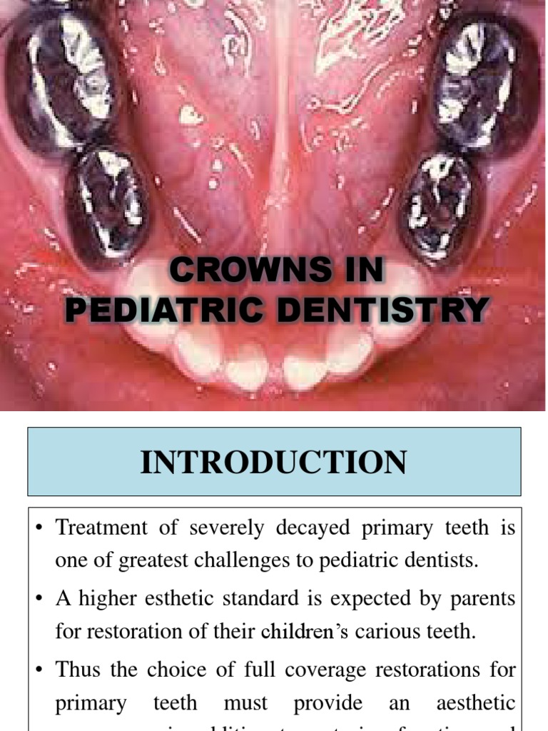 PDF of SSC Crown | Download Free PDF | Dentistry | Dentistry Branches