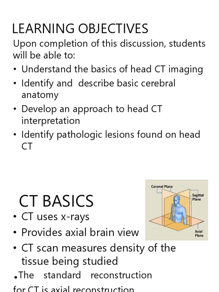 CT Scan Basics | PDF | Ct Scan | Neuroscience