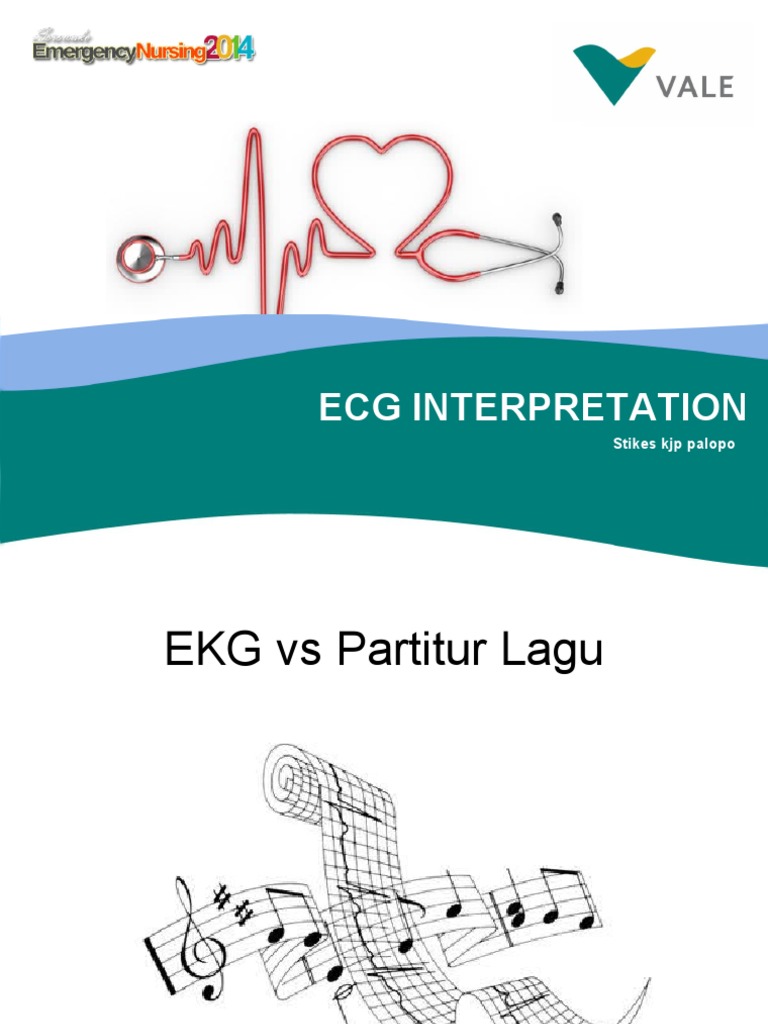 EKG (Workshop SEN 2014) | PDF