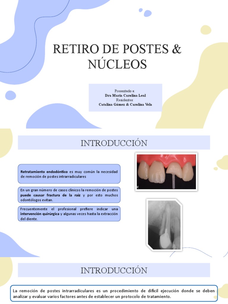 Remoción de Postes Intrarradiculares | PDF | Fibras | Ultrasonido