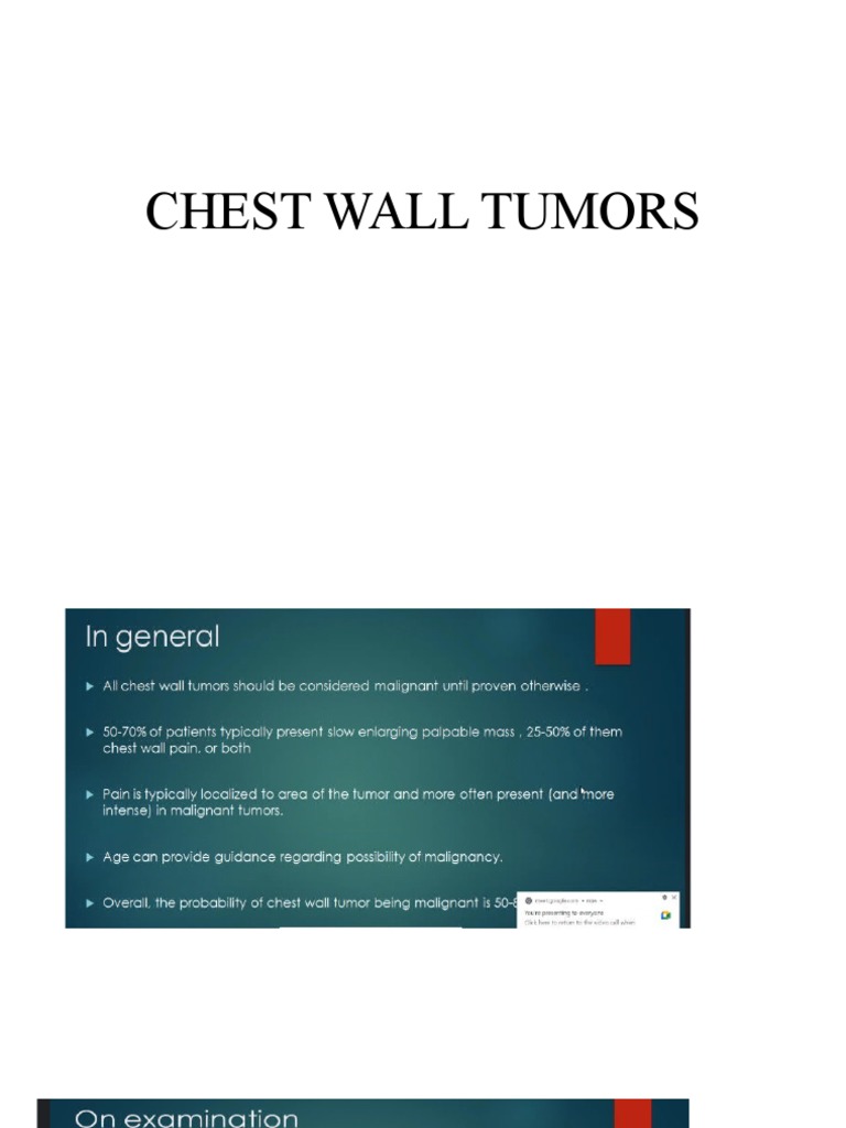 Chest Wall Tumors | PDF