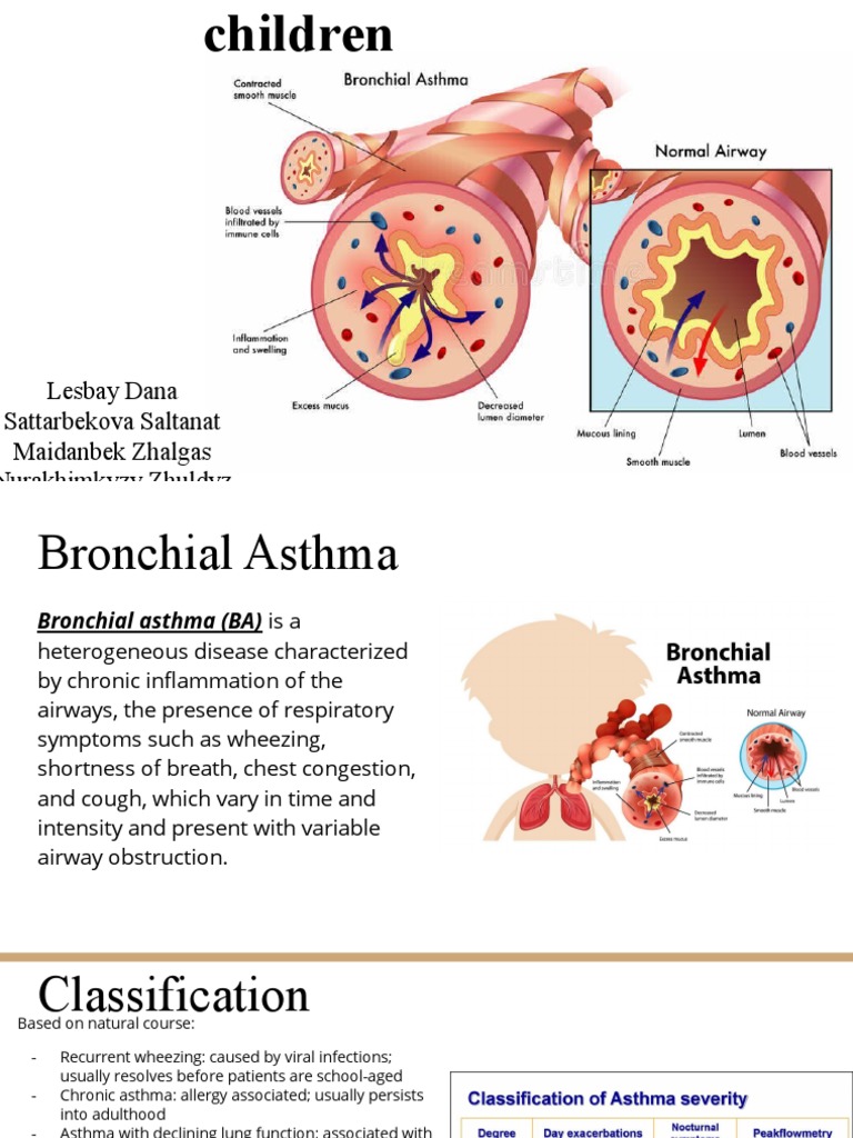 Bronchial Asthma in Children | PDF