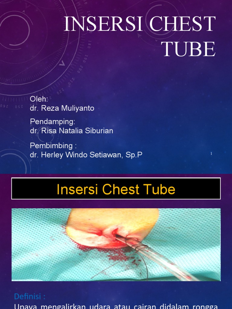 Chest Tube | PDF