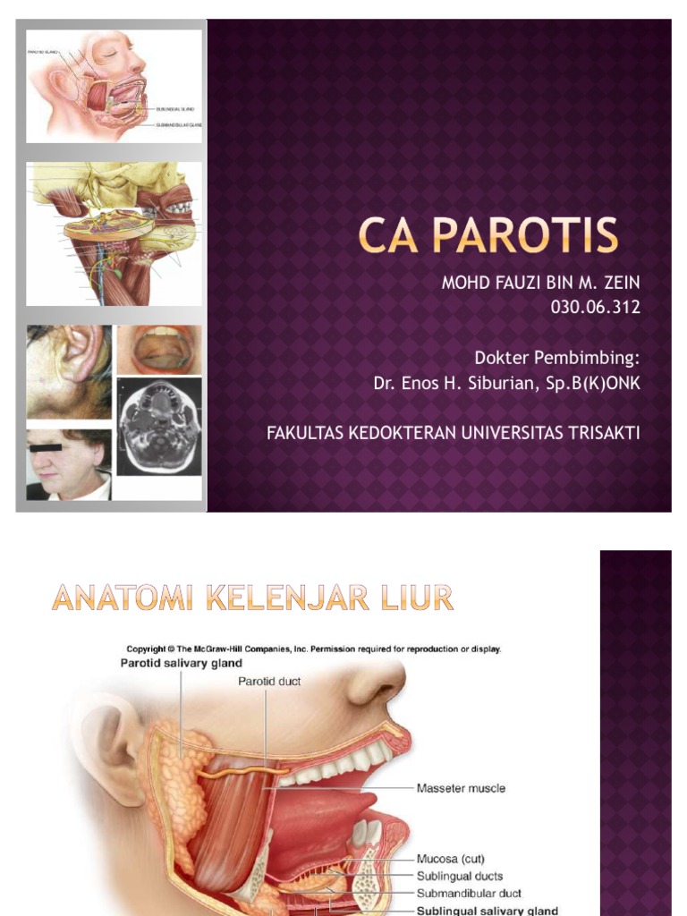 Ca Parotis | PDF | Sains & Matematika