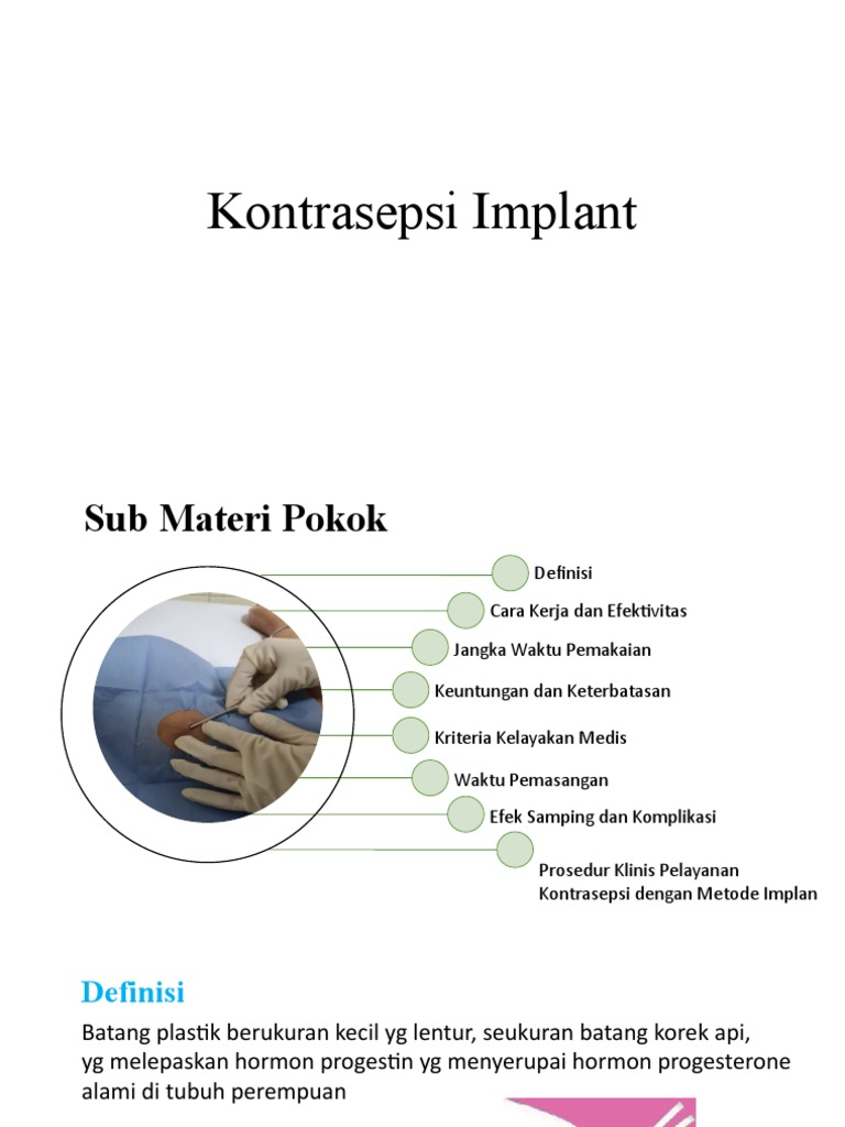 Panduan Kontrasepsi Implan Terperinci | PDF