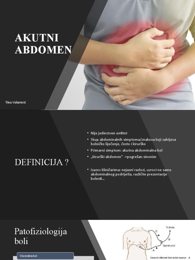 Akutni Abdomen | PDF