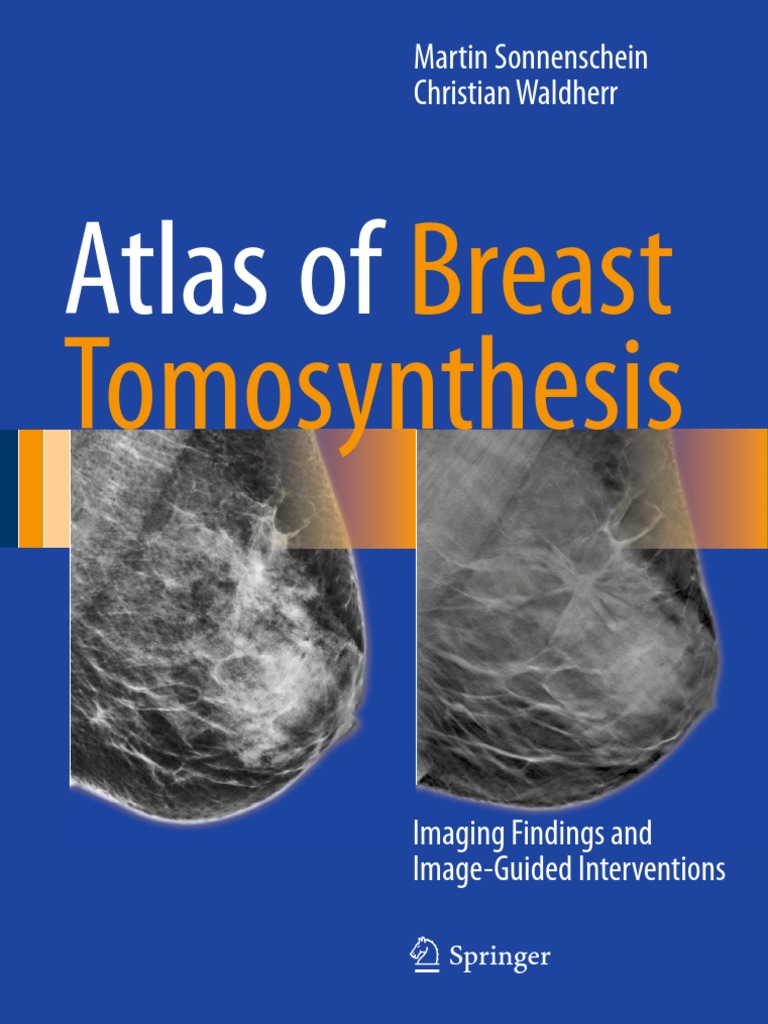Atlas of Breast Tomosynthesis | PDF | Ct Scan | Mammography