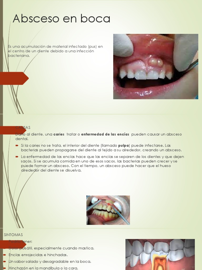 Absceso dental: causas y tratamiento | PDF | Odontología | Ciencias de ...