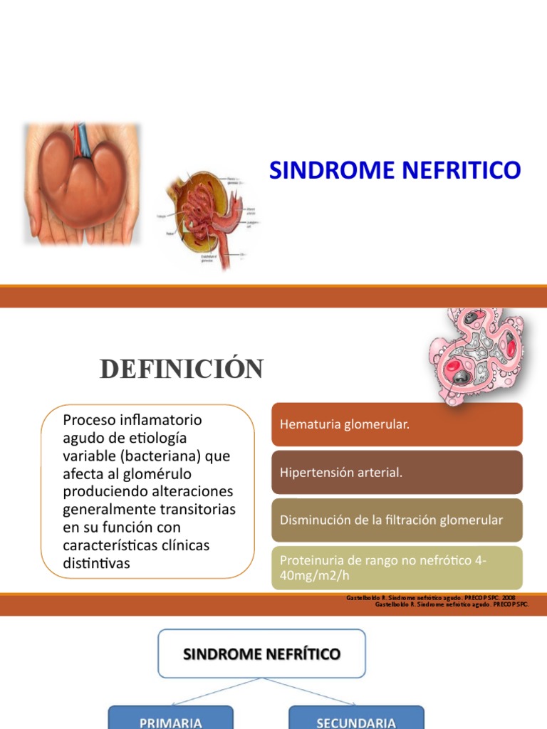 Síndrome Nefrítico: Definición y Síntomas | PDF | Ciencias de la Salud ...