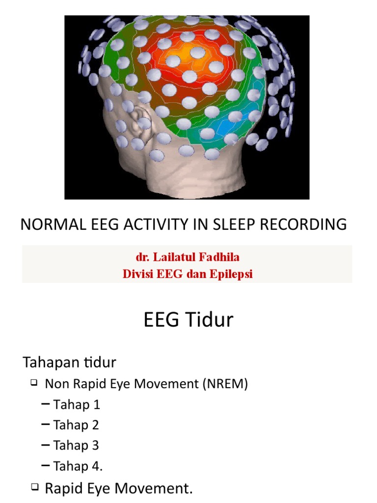 Normal Eeg Activity in Sleep Recording | PDF