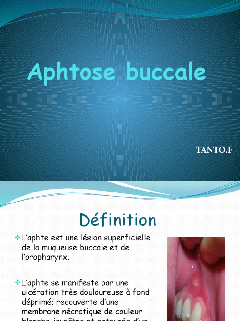 Aphte | PDF | Médecine | Maladies et troubles