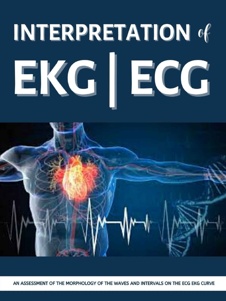 Kathy Stevens - Interpretation of EKG _ ECG_ Illustrated Practical ...