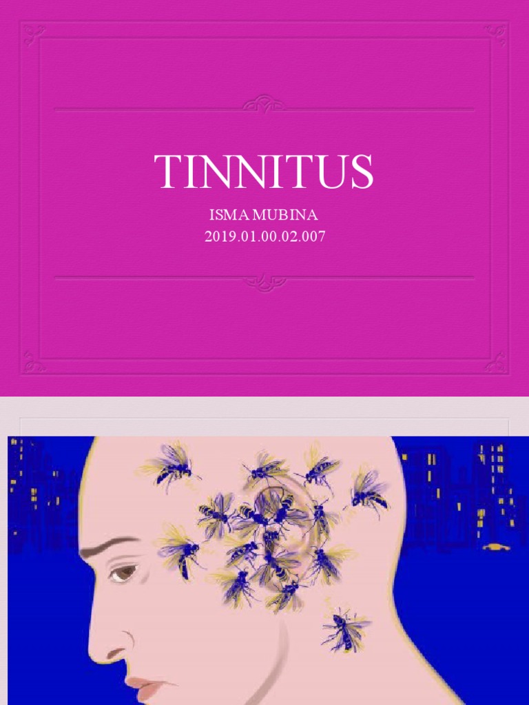 Tinnitus | PDF