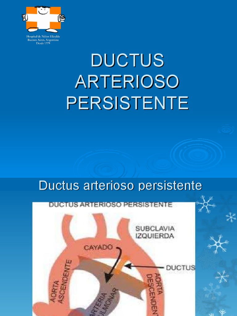 Ductus Arterioso Persistente | PDF