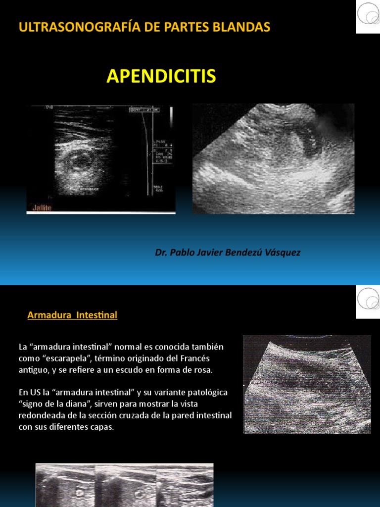 Ecogragia Apendicitis | PDF | Especialidades Medicas | Anatomía
