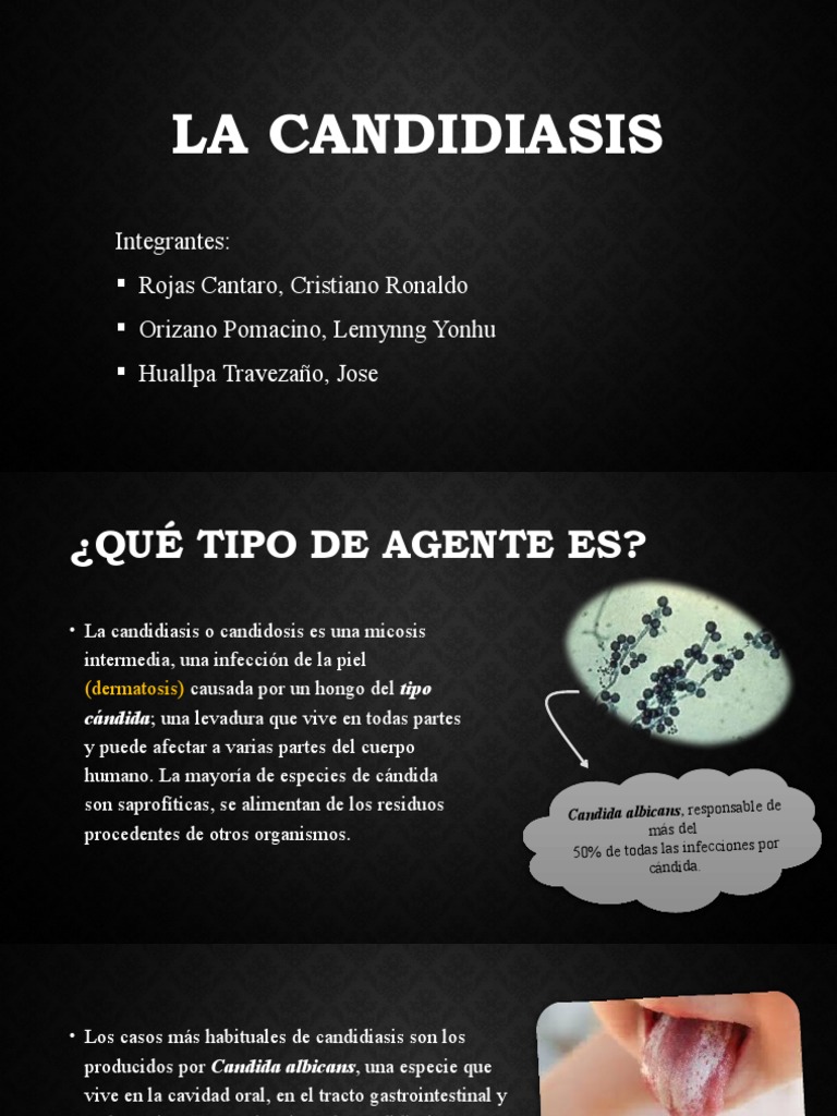 La Candidiasis | PDF | Candidiasis | Medicina CLINICA