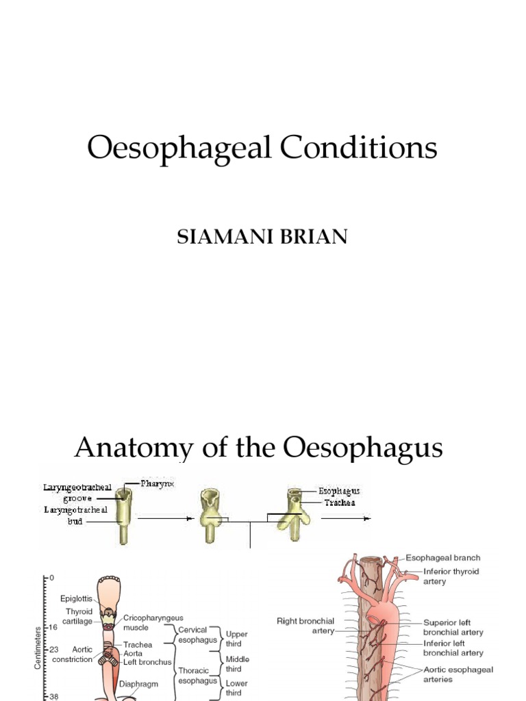 Esophageal Conditions | PDF | Esophagus | Esophageal Cancer