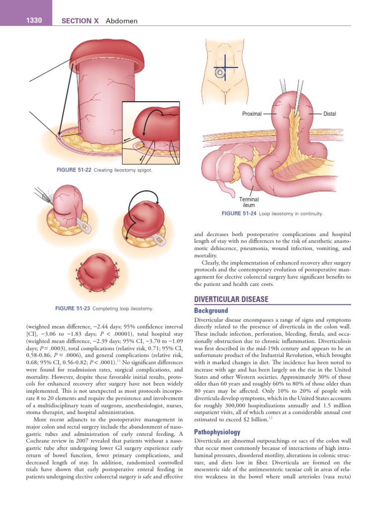 SABISTON Enf Diverticular Colon | PDF | Causes Of Death | Medical Specialties