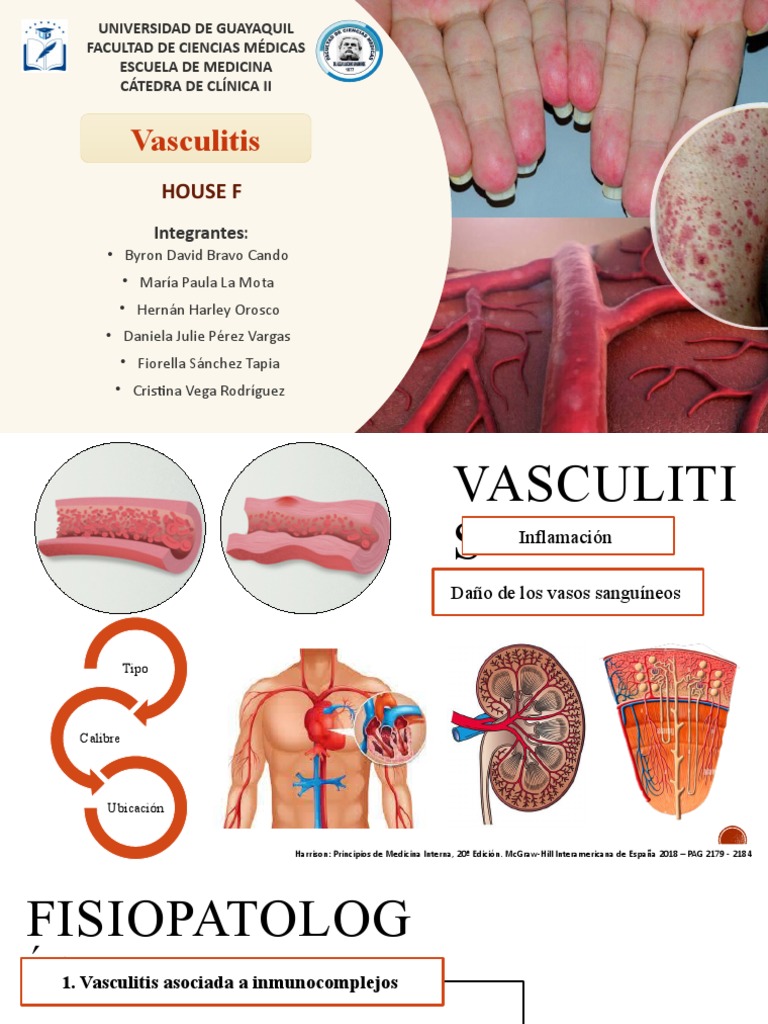 Diapositivas Clinica Vasculitis | PDF