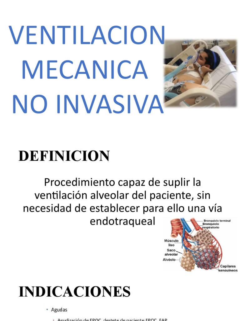 Ventilación Mecánica No Invasiva: Guía Completa | PDF
