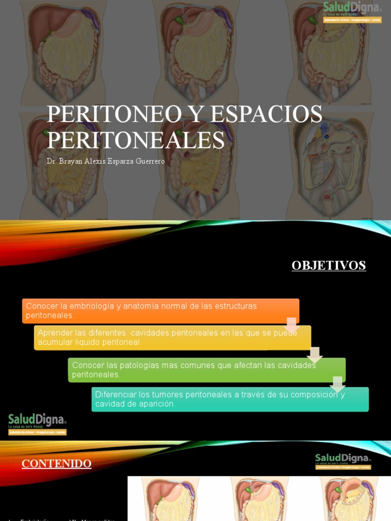 Peritoneo y Espacios Peritoneales | PDF | Abdomen | Peritoneo