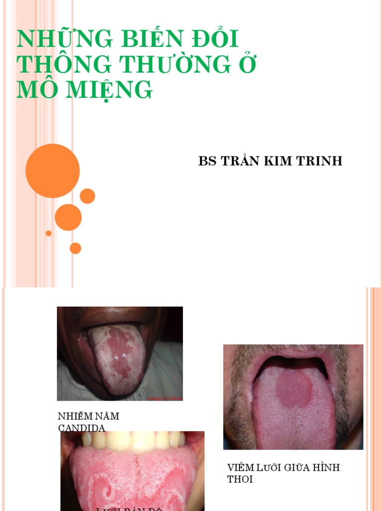Bien Doi Thong Thuong Mo Mieng | PDF
