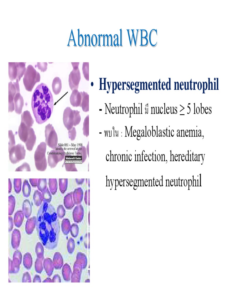 Blood Smear examination-P26-P50 | PDF