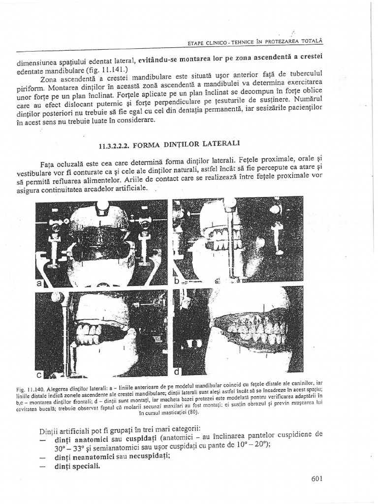BAZELE CLINICE ŞI TEHNICE ALE PROTEZĂRII FIXE (Partea 4) | PDF