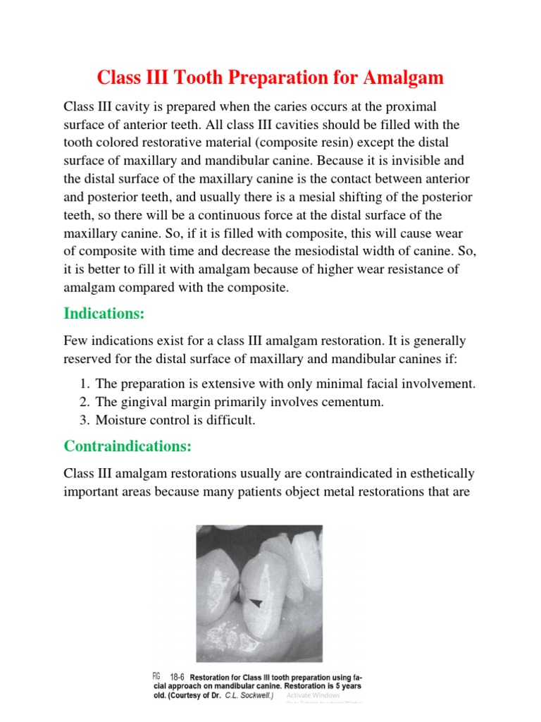 Class III Tooth Preparation For Amalgam: Indications | PDF | Dentistry ...