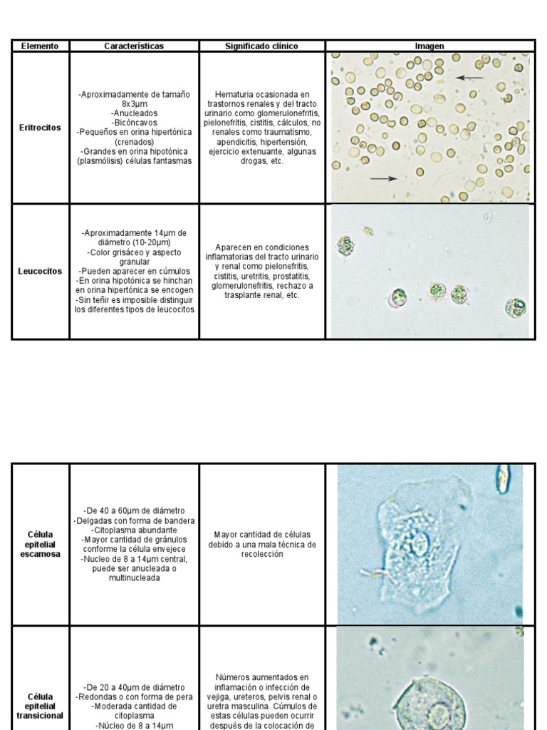 Análisis Microscópico de La Orina | PDF | Riñón | Órgano (anatomía)