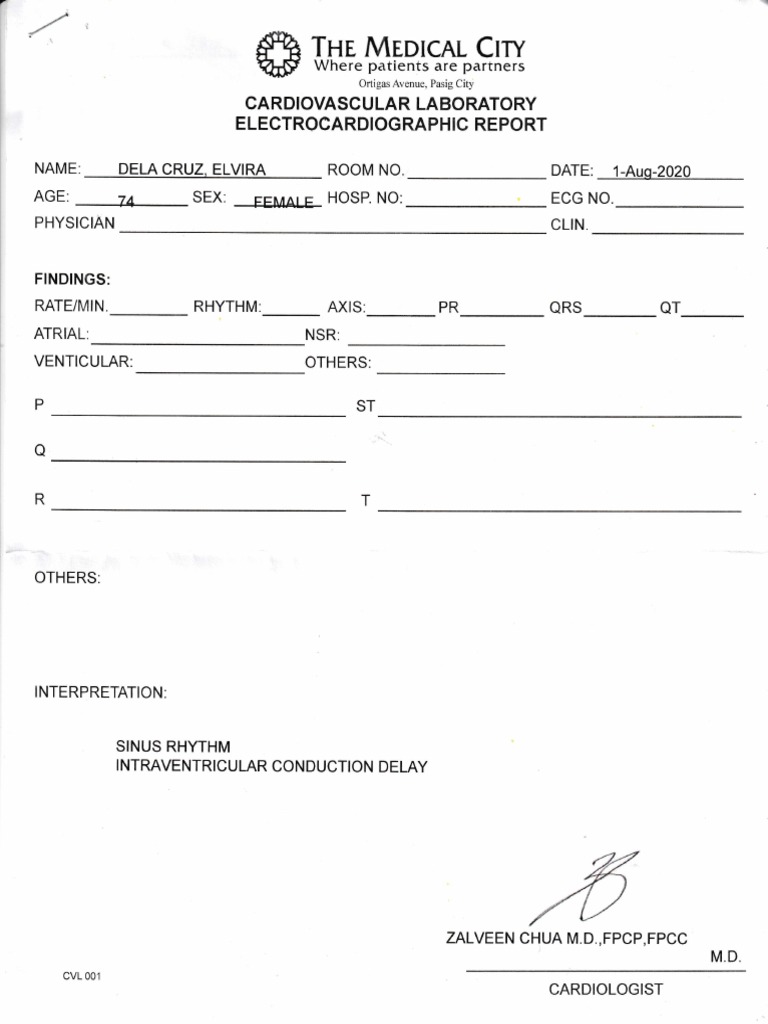ECG Report: IVCD Findings for Zalveen Chua | PDF