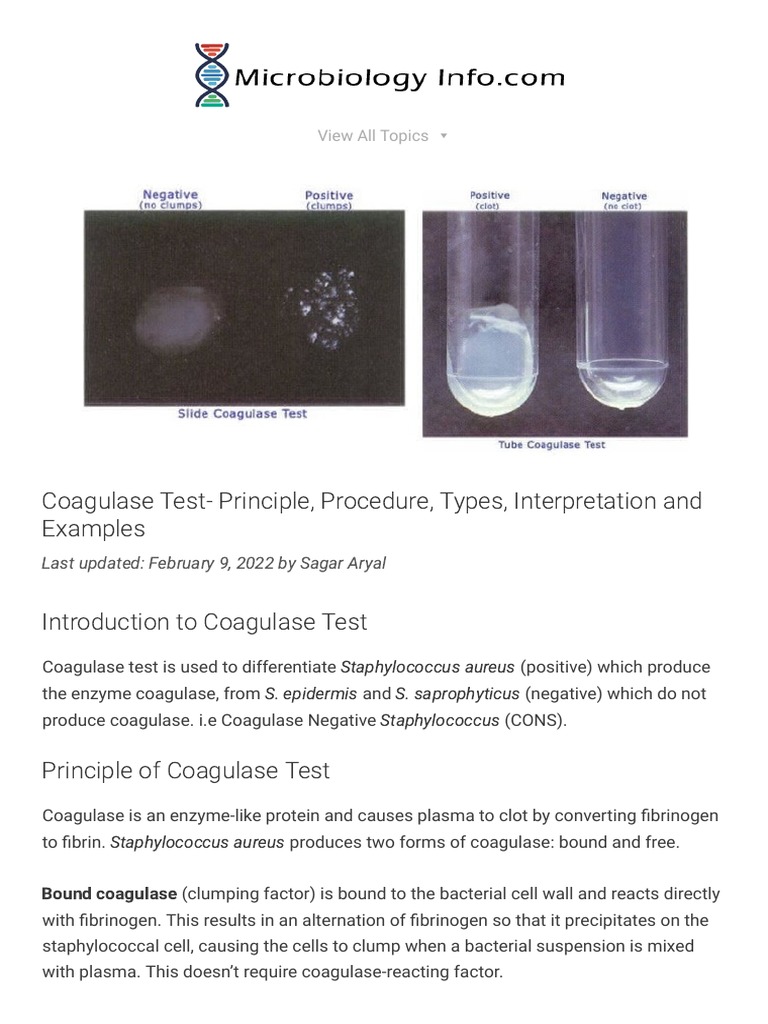 Coagulase Test - Principle, Procedure, Types, Interpretation and ...