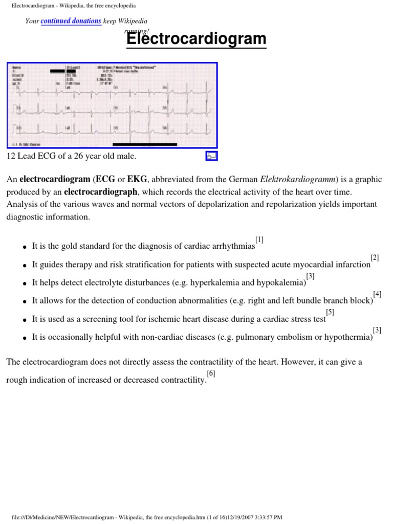 Electrocardiogram - Wikipedia, The Free Encyclopedia | PDF ...