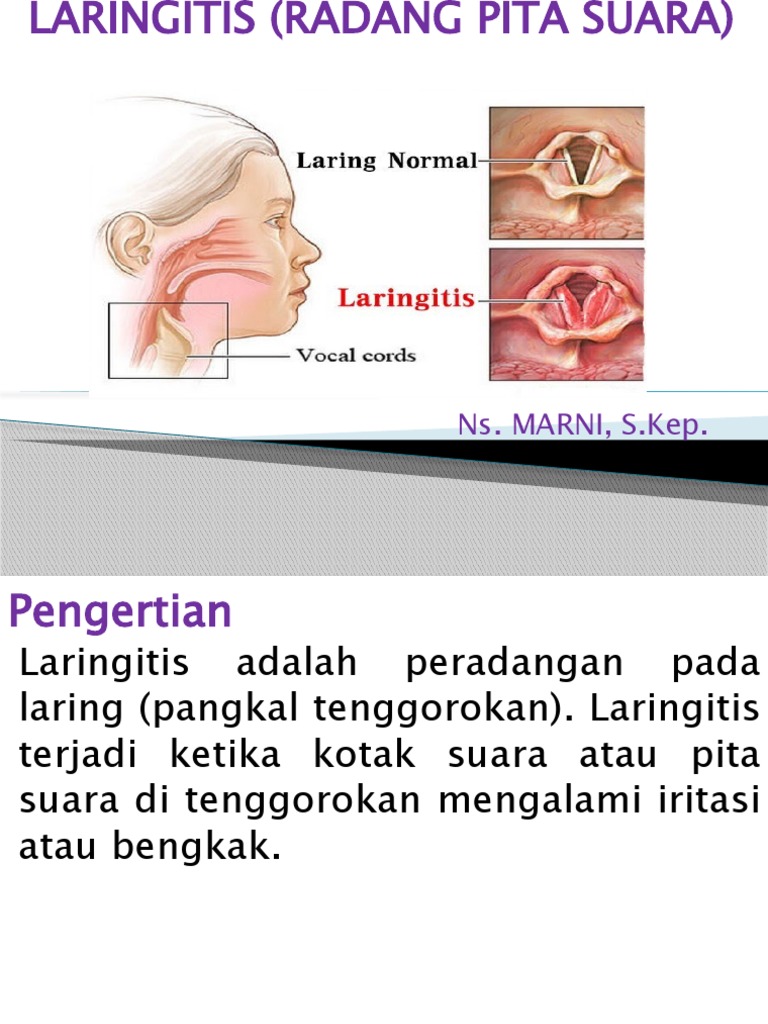 Laringitis | PDF