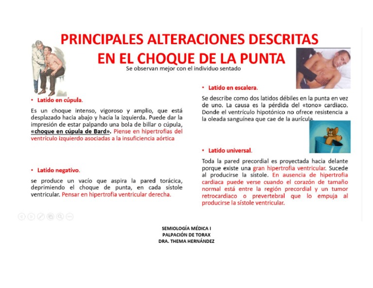 Principales Alteraciones Del Choque de Punta | PDF