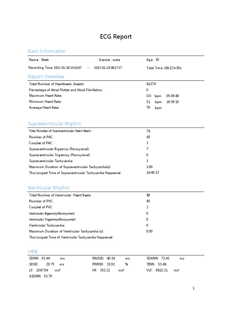 ECG Report | PDF