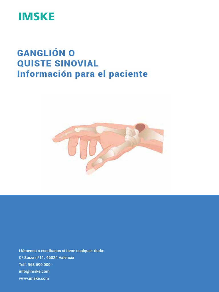 Ganglio o Quiste Sinovial25-02 B | PDF | Mano | Articulación