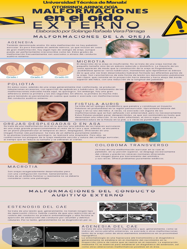 Infografía de Las Malformaciones Del Oído | PDF