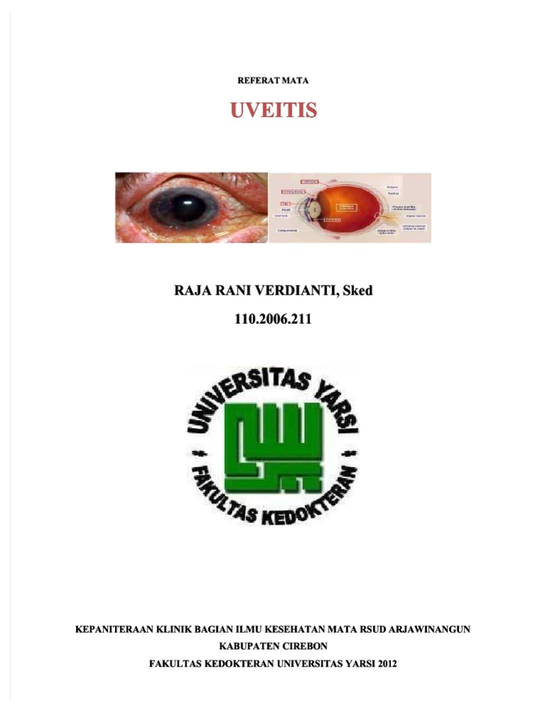 Uveitis | PDF