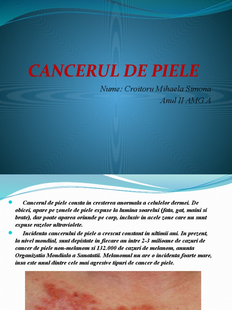 Cancerul de Piele | PDF