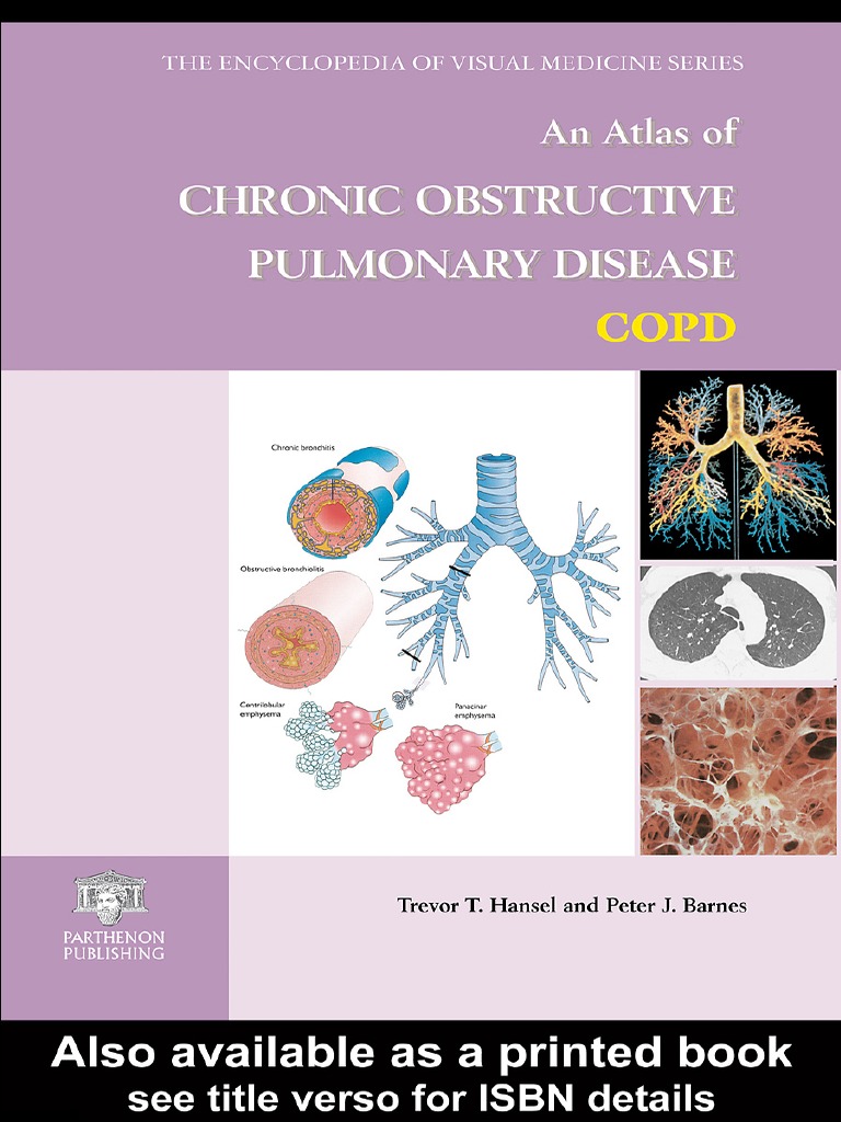 An Atlas of Chronic Obstructive Pulmonary Disease, COPD (Hansel, Trevor ...