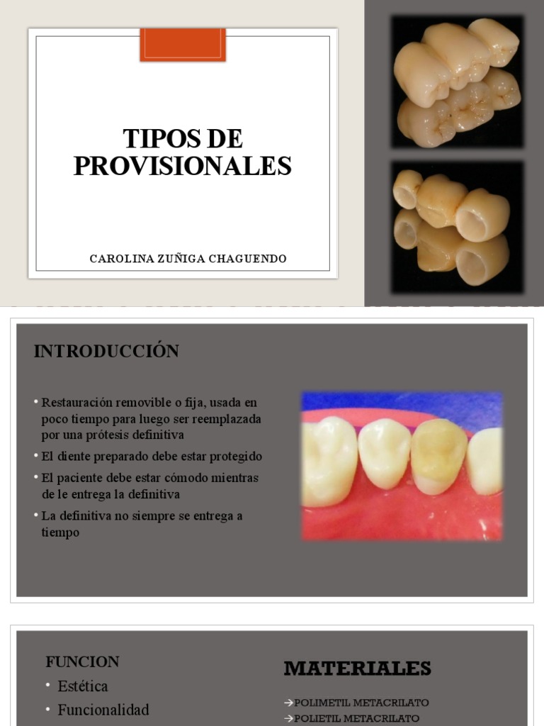 Tipos de Provisionales | PDF | Dentadura postiza | Materiales