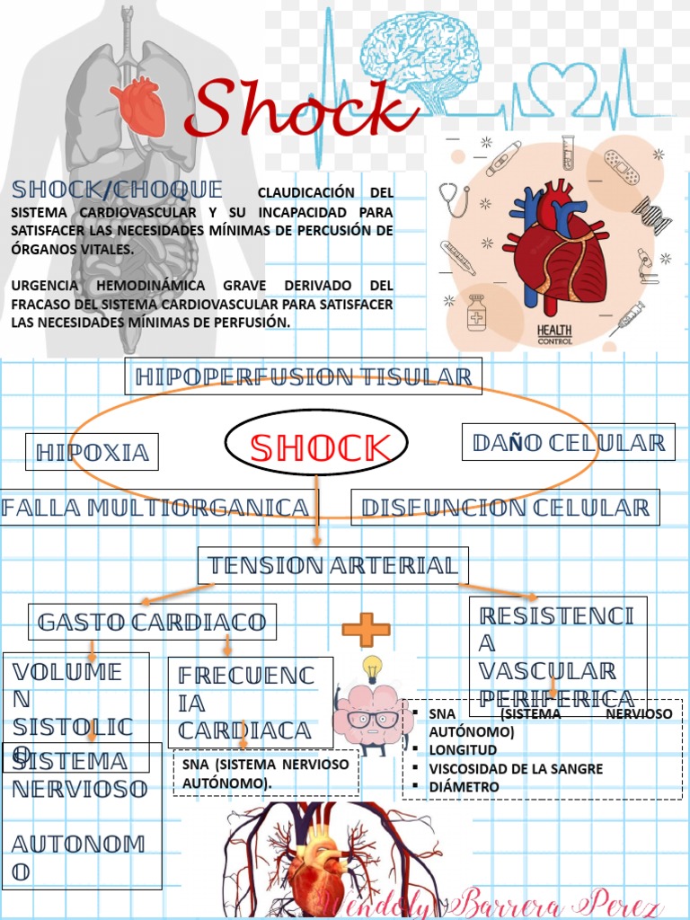 Shock | PDF | Septicemia | Medicina