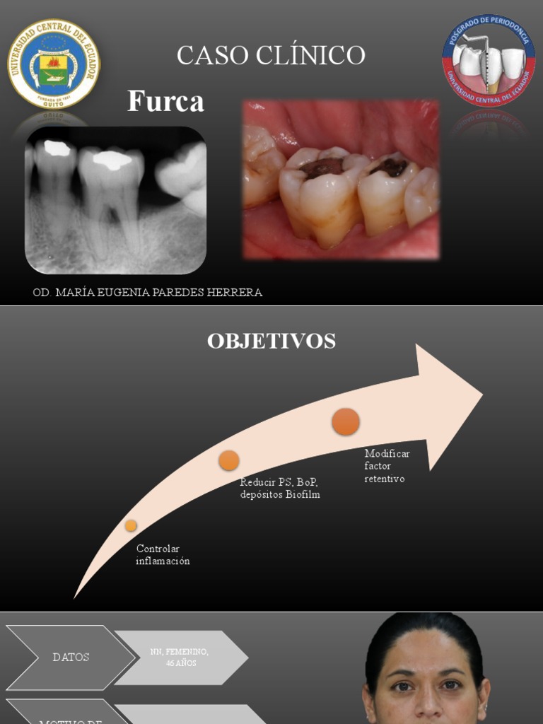 Caso Furca Presentacion | PDF | Odontología | Medicina